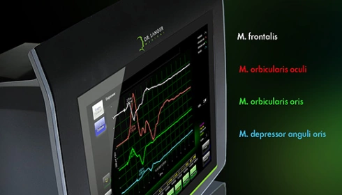 langer medical - OM - ENT surgery - neuromonitoring - IONM