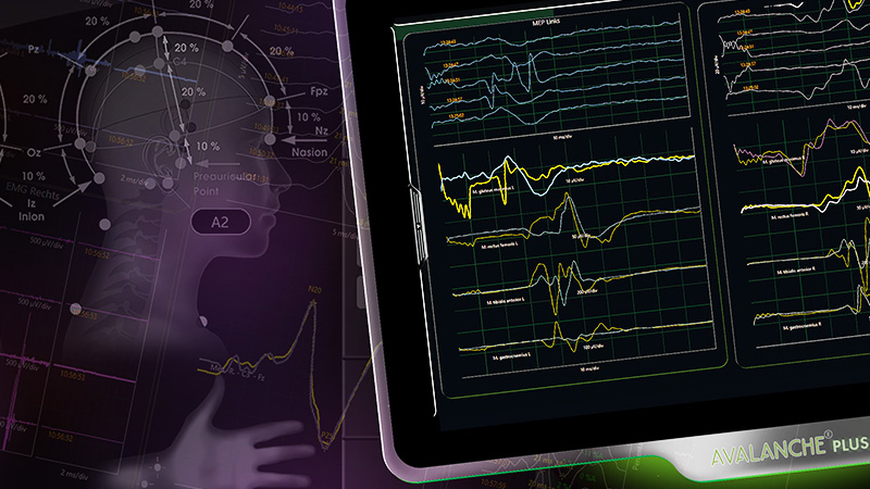 langer medical - neurosurgery - neuromonitoring - IONM